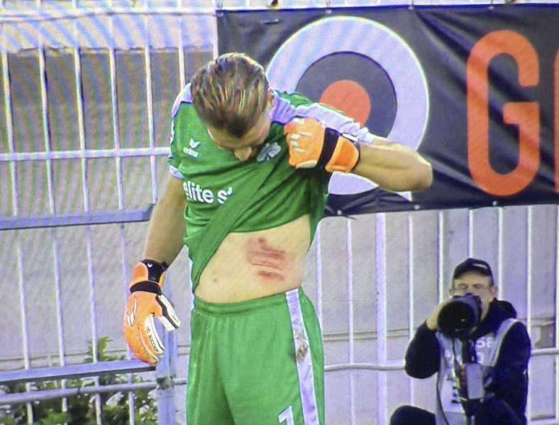 Η σοκαριστική εικόνα του Ξενόπουλου μετά το χτύπημα του Πιερό! (vid &pic) | SDNA