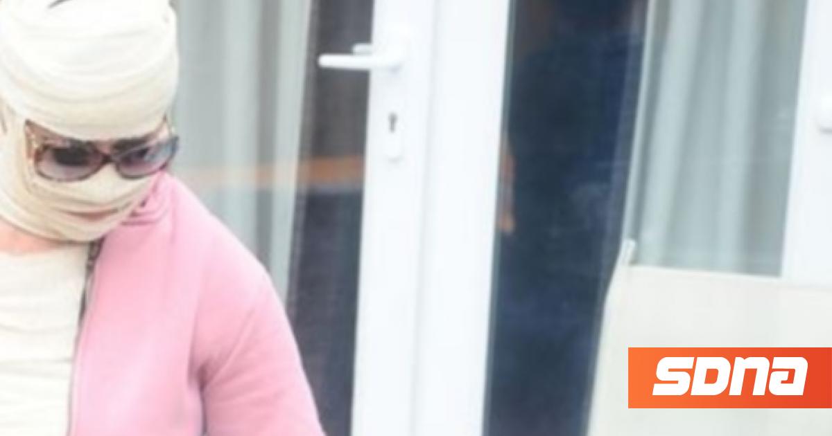 Τι της συνέβη; Περιορισμένη στο σπίτι με επιδέσμους στο πρόσωπο γνωστή κυρία της showbiz! | SDNA