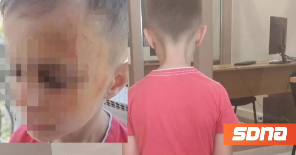 Σοκαριστικό περιστατικό στο Αγρίνιο: Μαθητές νηπιαγωγείου ξυλοκόπησαν 5χρονο - Του ζήτησαν να ...